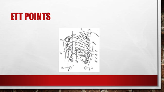 EET (Exercise Tolerance Test ) | PPTX