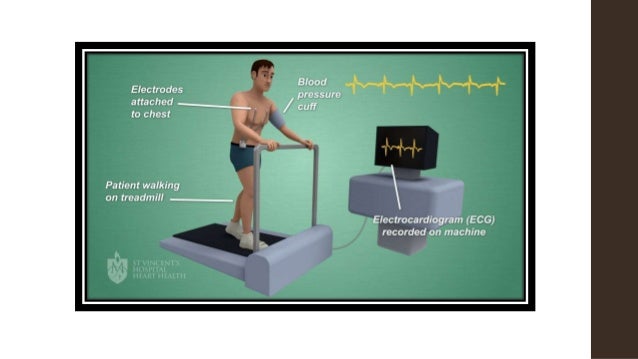 Exercise Tolerance Test exercise-tolerance-test