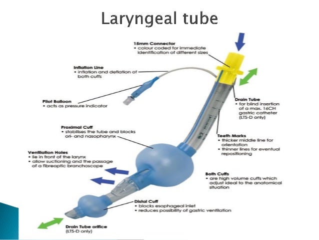 ENDOTRACHEAL TUBE INTUBATION II Parts II Details II Clinical Discussi…