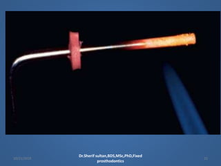 restoration of endodontically treated teeth cast post | PPTX