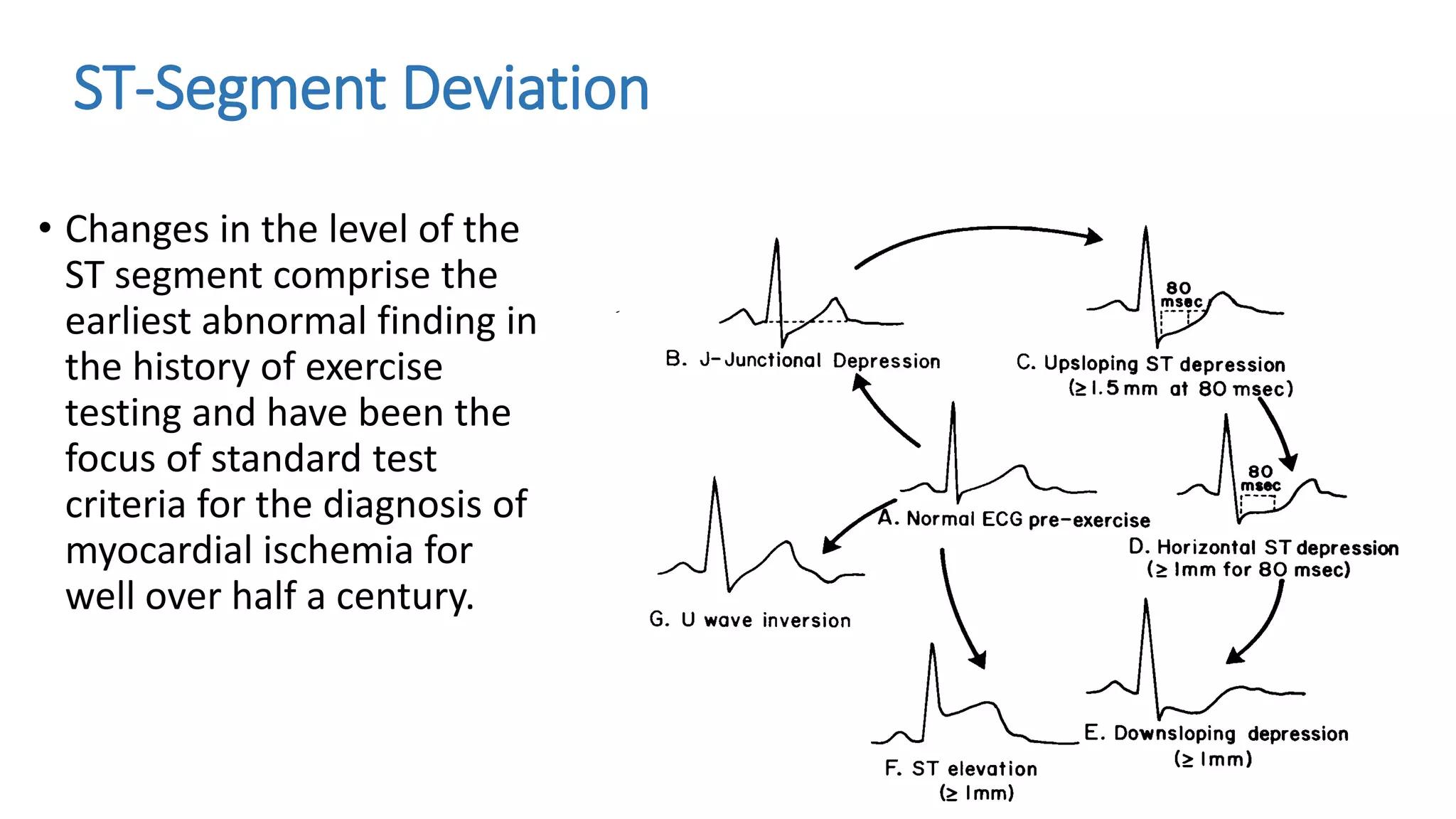 Exercise Tolerance Test | PPTX