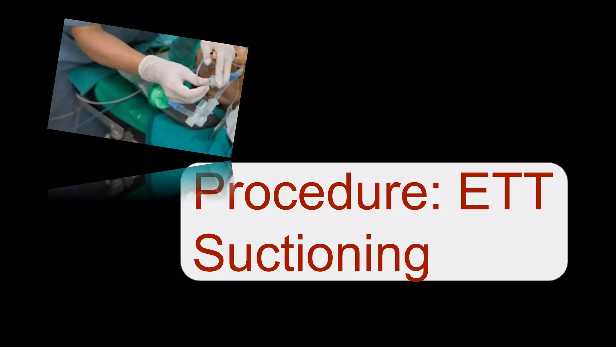 Endotracheal Suction(ETS} : Principle and Practice | PDF