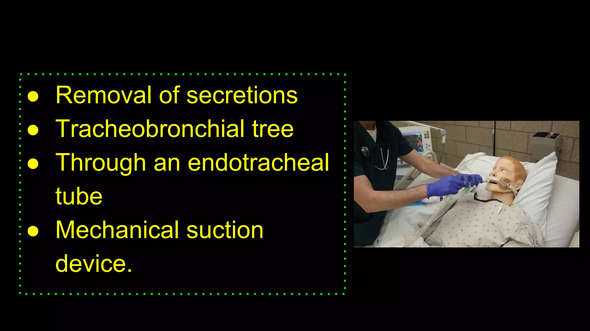 Endotracheal Suction(ETS} : Principle and Practice | PDF