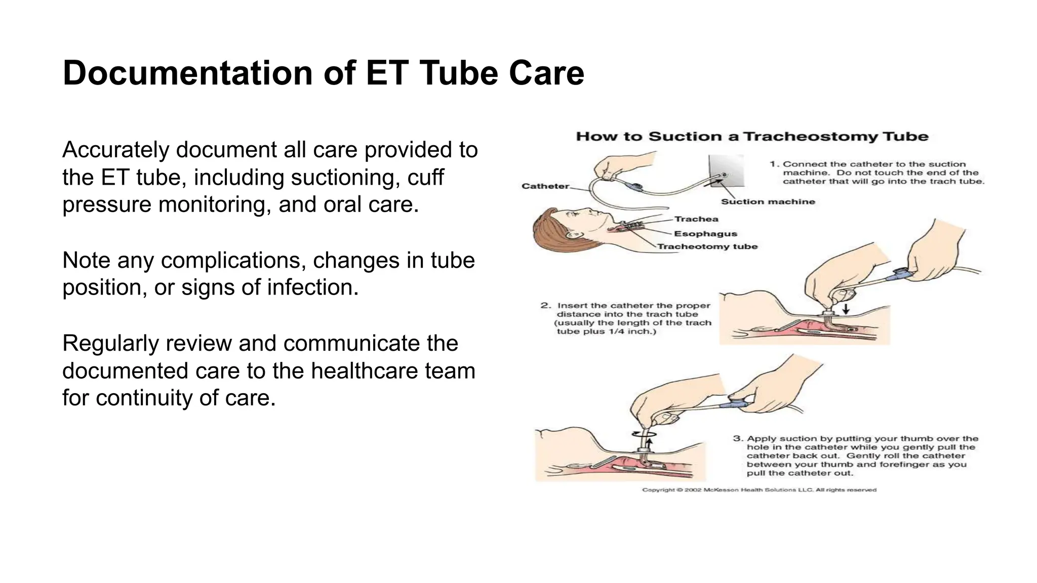 Et Tube Care.pptx