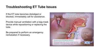 Et Tube Care.pptx | First Aid | Injuries