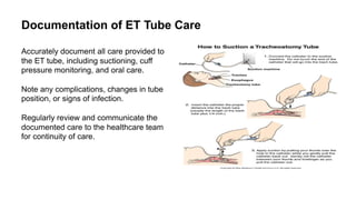 Et Tube Care.pptx | First Aid | Injuries