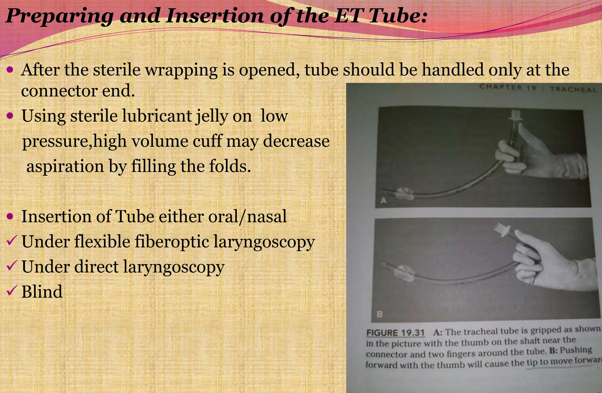 ET TUBES presentation by Dr. Animesh Aman Singh | PPTX