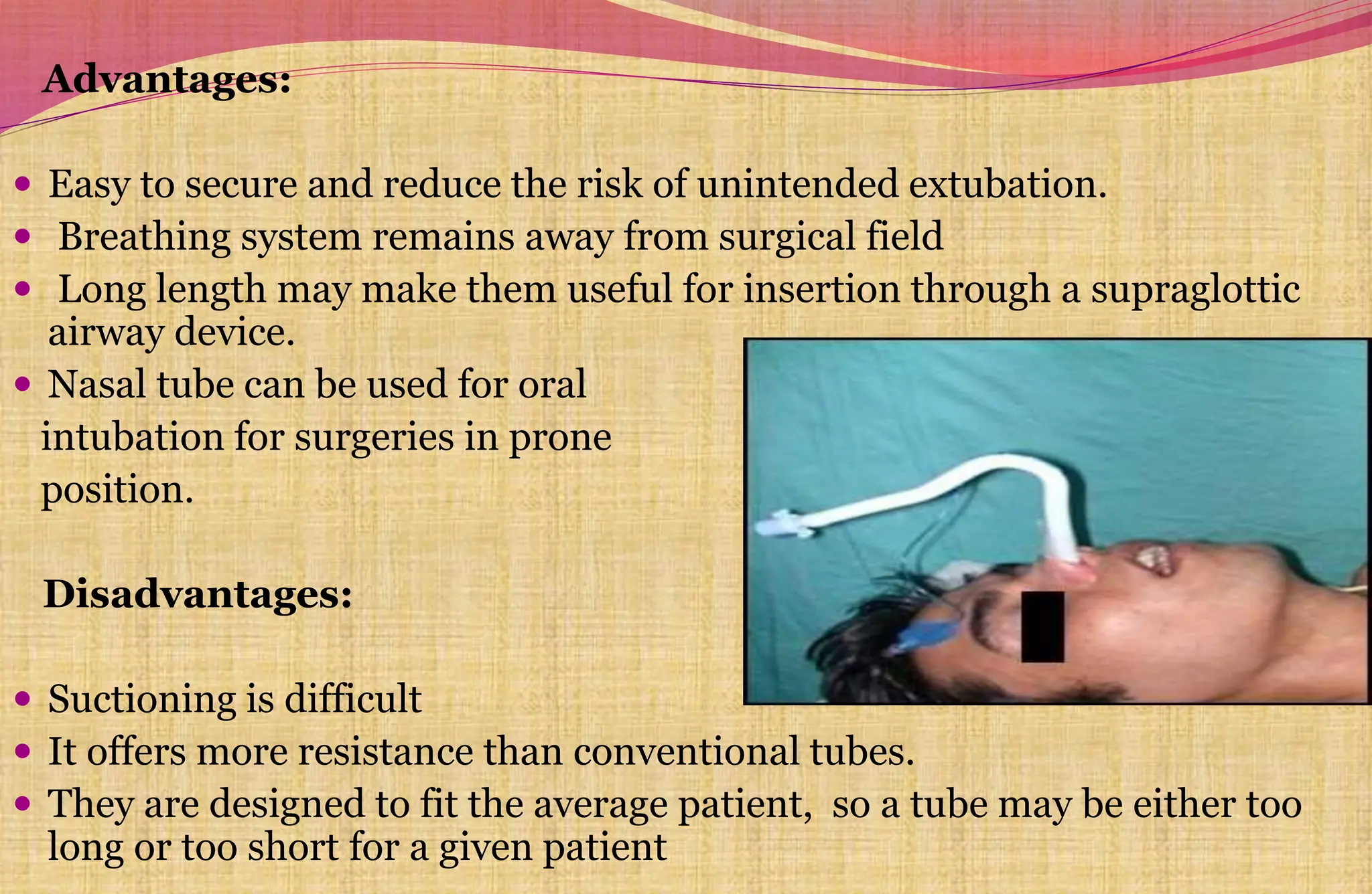 ET TUBES presentation by Dr. Animesh Aman Singh | PPTX