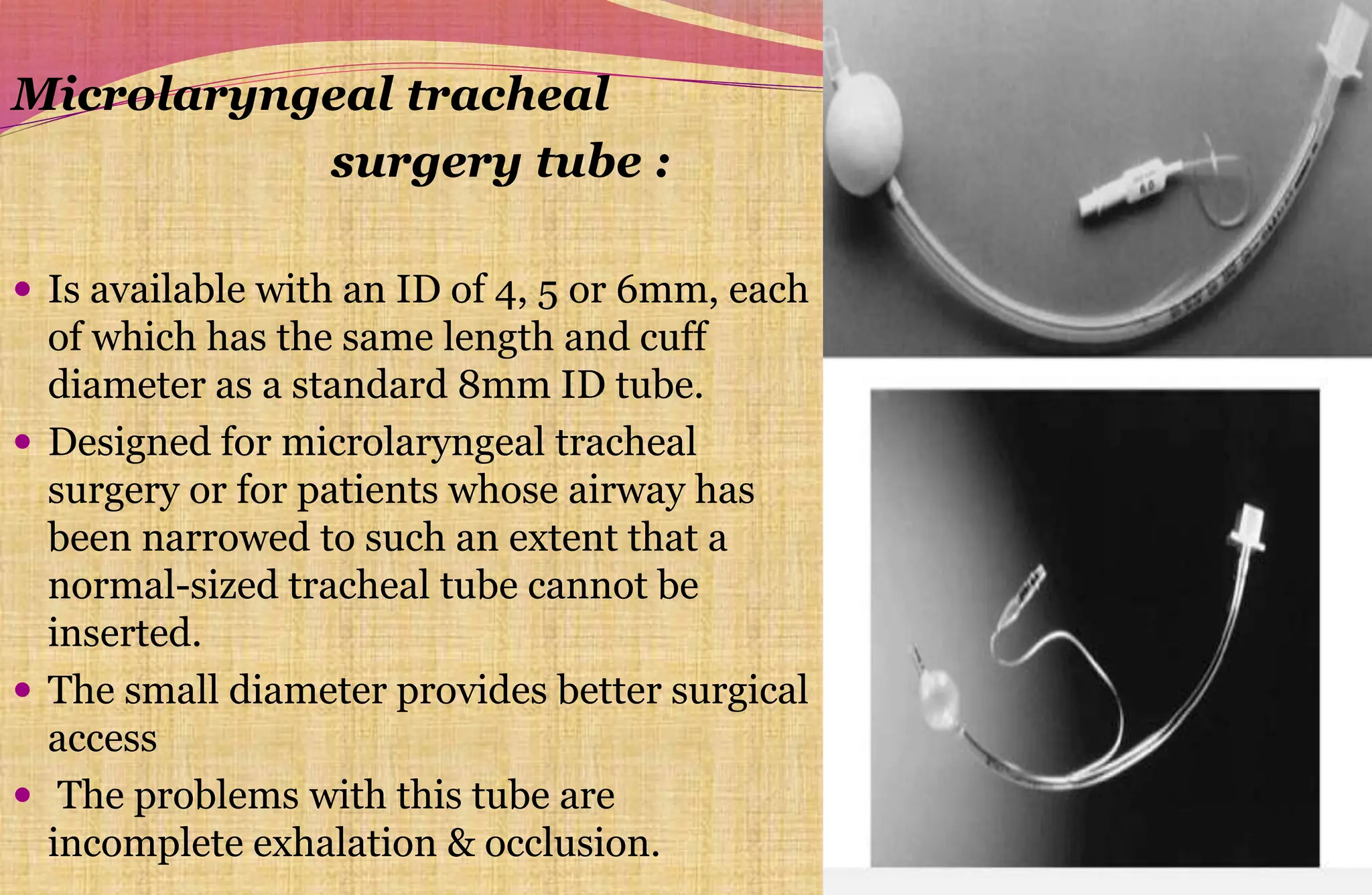 ET TUBES presentation by Dr. Animesh Aman Singh | PPTX