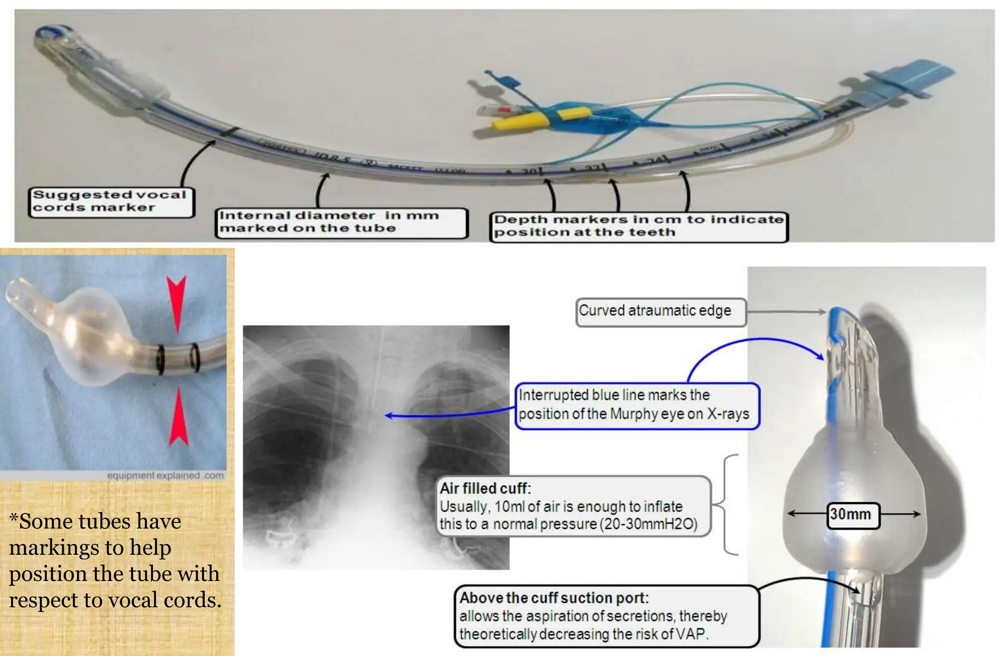 ET TUBES presentation by Dr. Animesh Aman Singh | PPTX