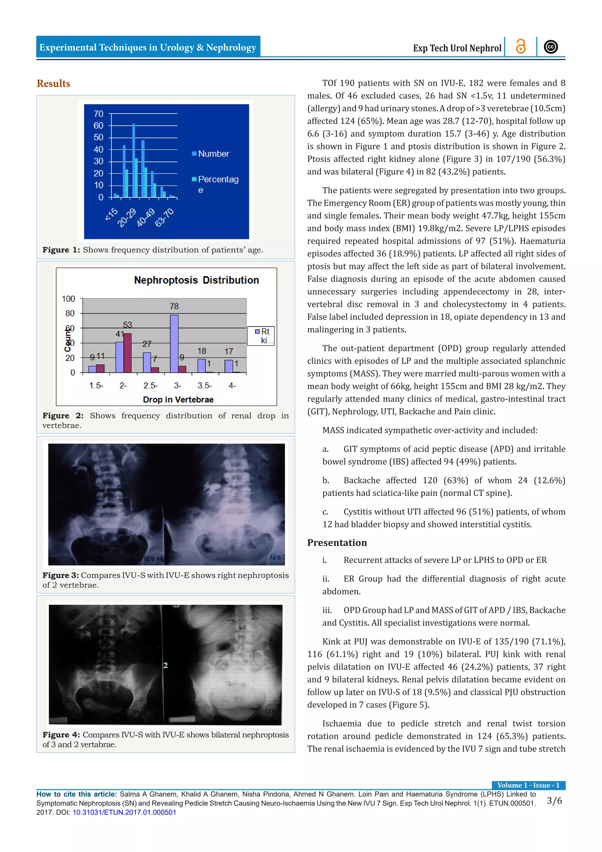 Crimson Publishers-Loin Pain and Haematuria Syndrome (LPHS) Linked to ...