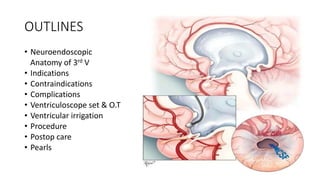 Endoscopic 3rd Ventriculostomy-DR.MUMTAZ ALI NAREJO.pptx