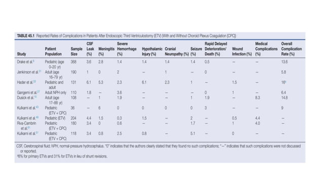 Endoscopic 3rd Ventriculostomy-DR.MUMTAZ ALI NAREJO.pptx