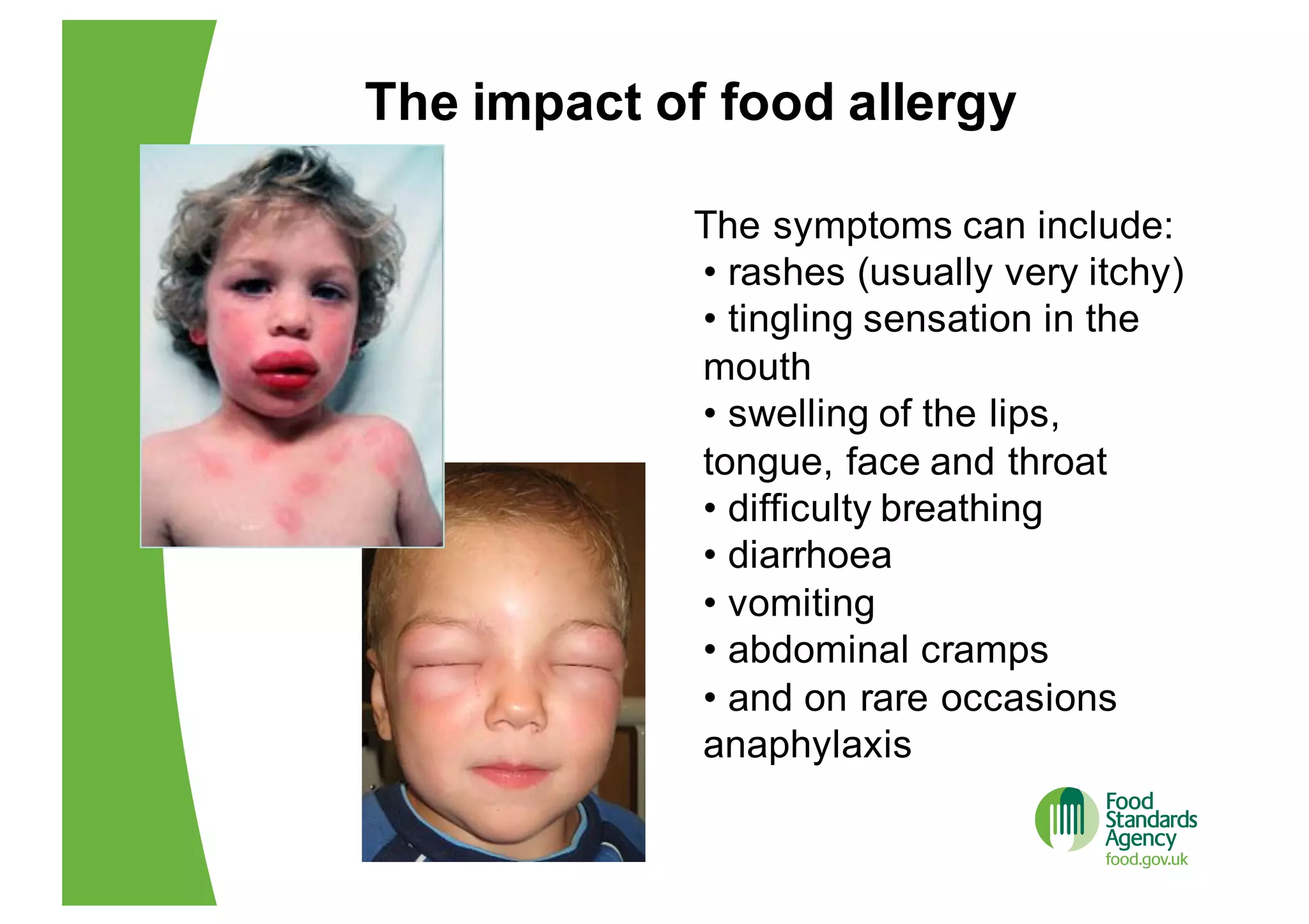 EU Food Regulations Food Allergen Labelling | PDF
