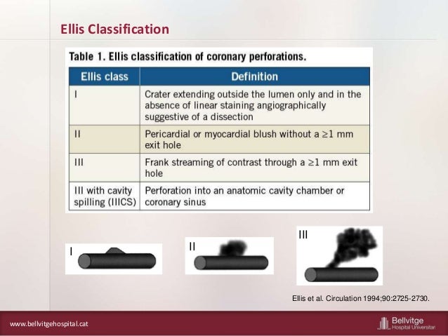 11:20 Teruel - Perforations