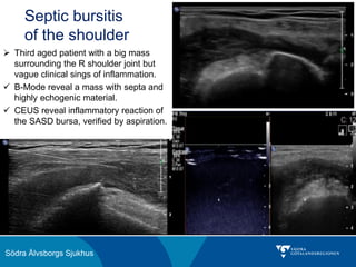 Euroson 2015 presentation inovative techniques for the diagnosis and ...