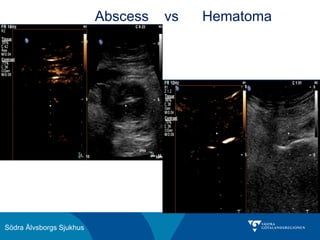 Euroson 2015 presentation inovative techniques for the diagnosis and ...
