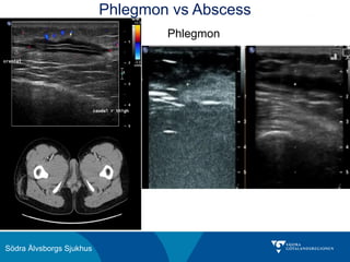 Innovative techniques for the diagnosis and treatment of soft tissue