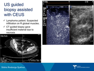 Euroson 2015 presentation inovative techniques athens | PPT