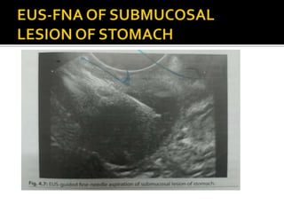 eus-200527113847.pdf