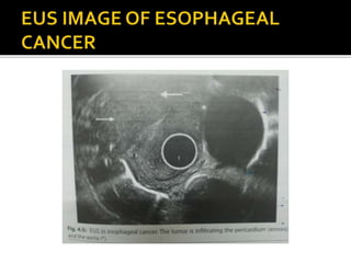 eus-200527113847.pdf