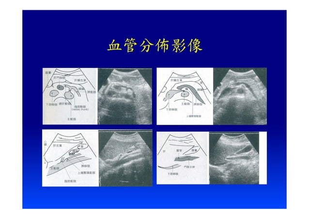 Eus教學(1)。急診超音波之介紹 & 超音波基本認識 | PDF