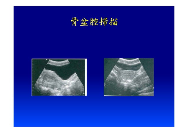 Eus教學(1)。急診超音波之介紹 & 超音波基本認識 | PDF