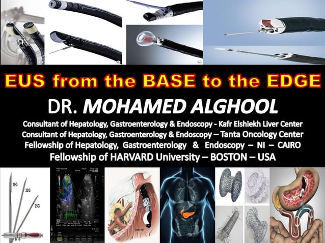 Endoscopic Ultrasound from the BASE to the EDGE.pdf