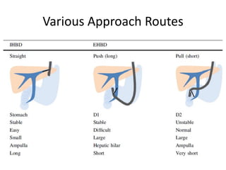 EUS Guided Interventions for Pancreatobiliary Tumours | PDF