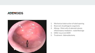 Eustachian tube and it's disorders, ENT | PPTX