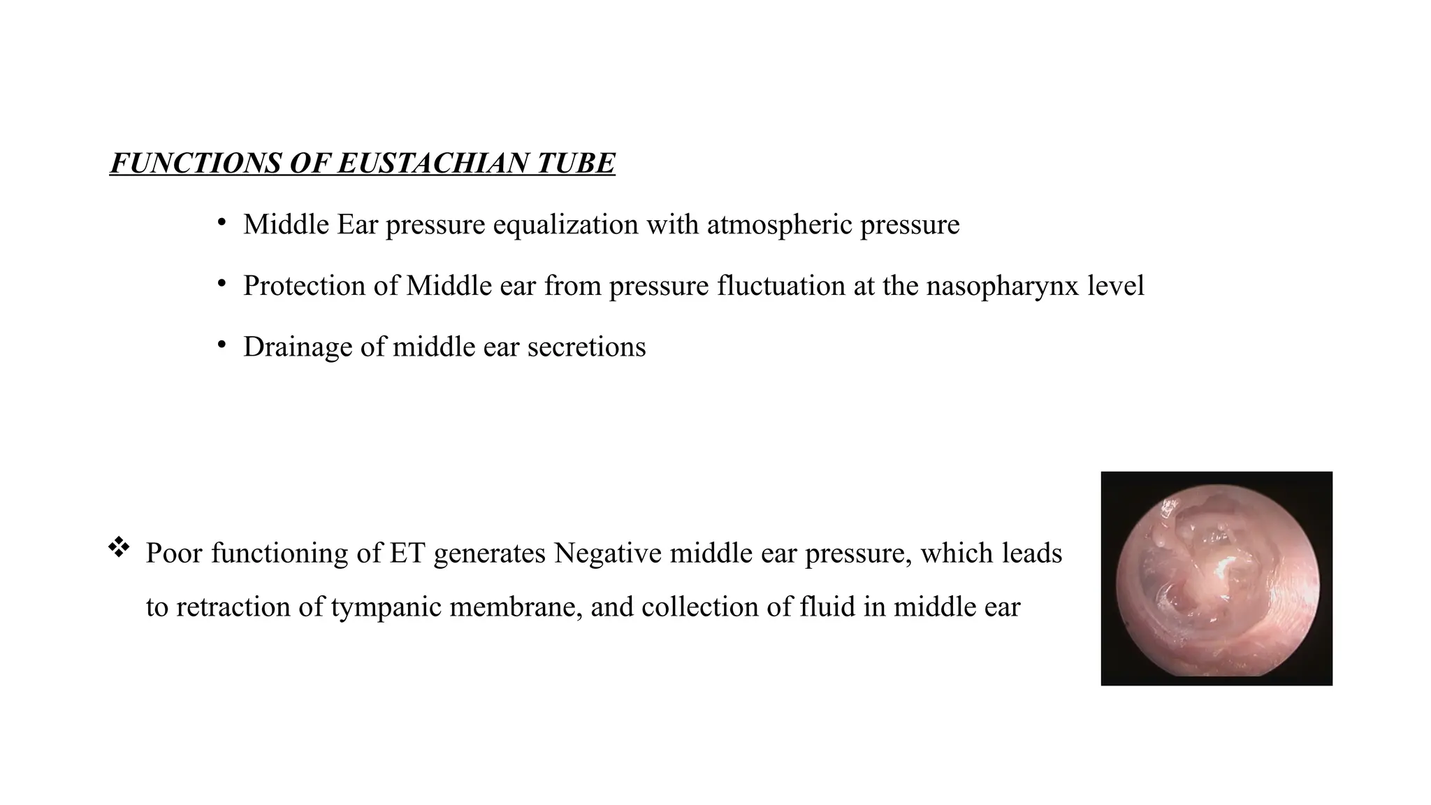 Eustachian Tube - Anatomy physiology and Disorders UG.pptx