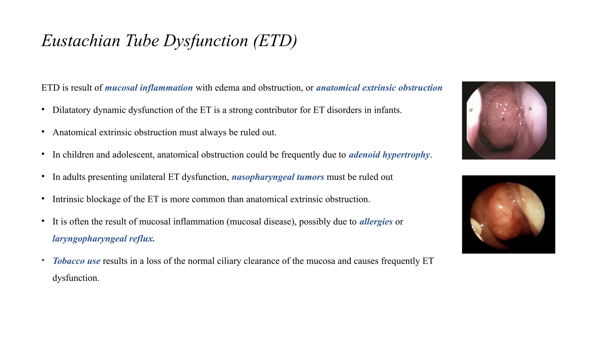Eustachian Tube - Anatomy physiology and Disorders UG.pptx