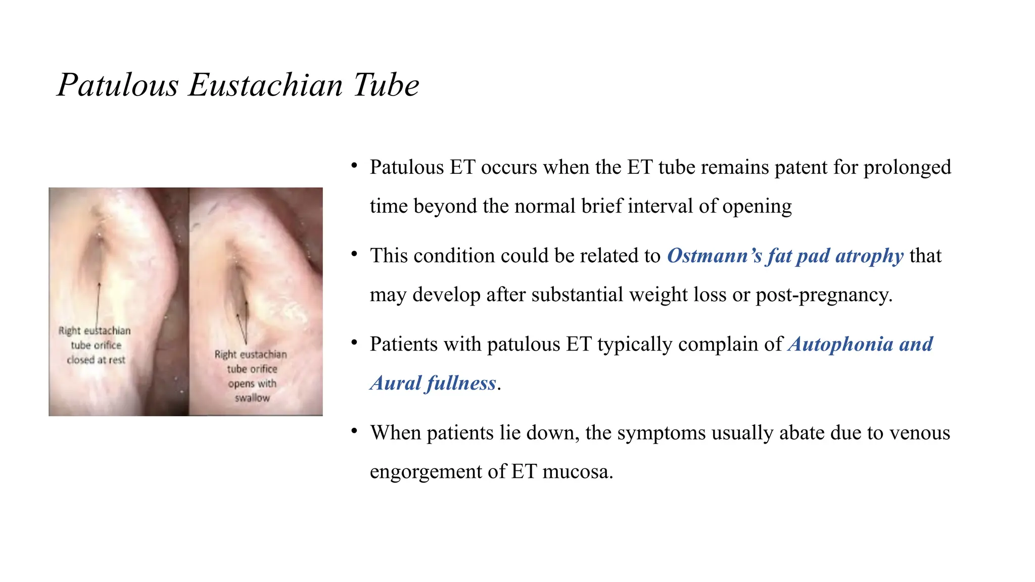 Eustachian Tube - Anatomy physiology and Disorders UG.pptx