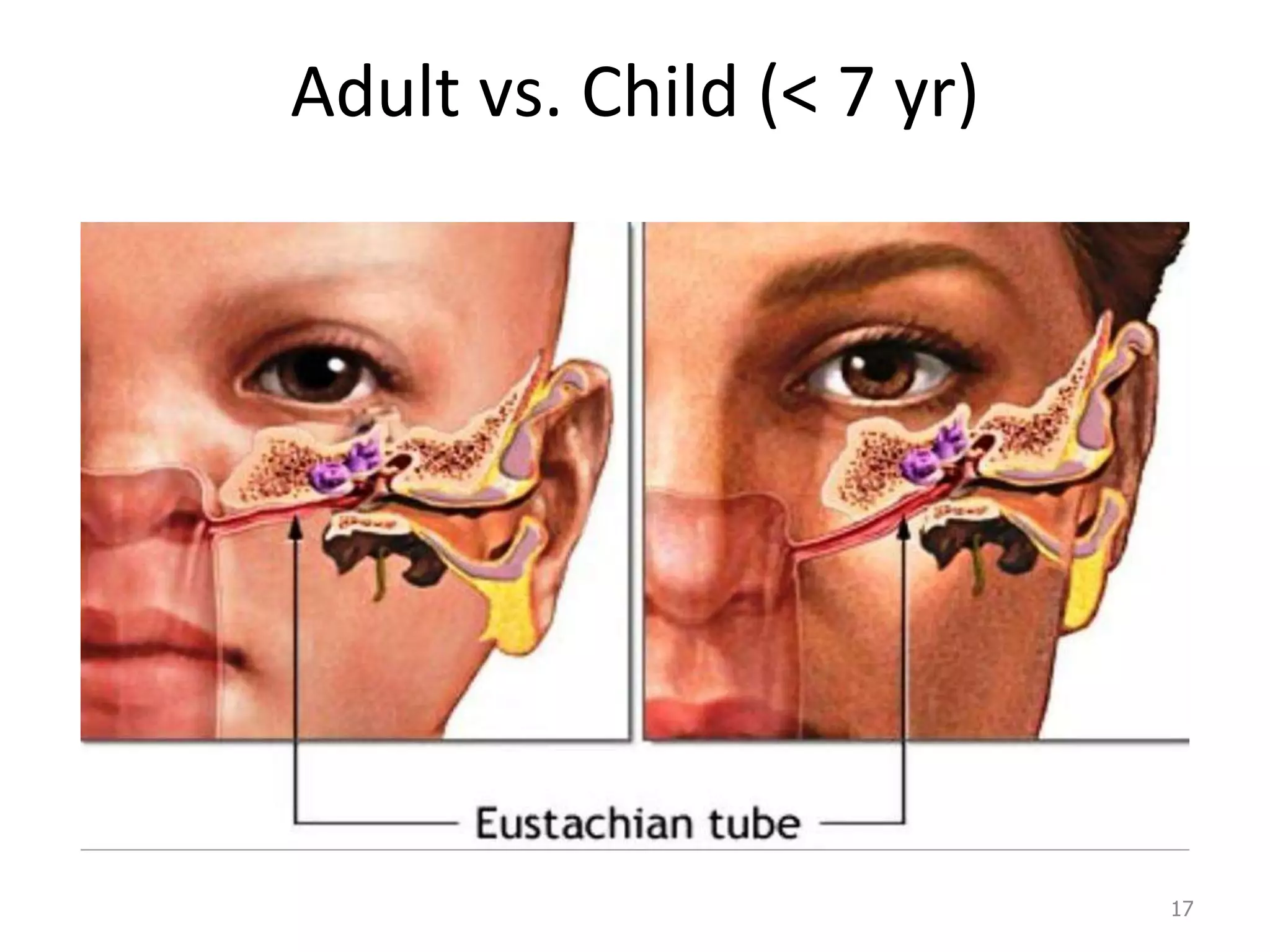 Eustachian tube, anatomy, test and disorders, dr.vijaya sundarm, 20.03.17