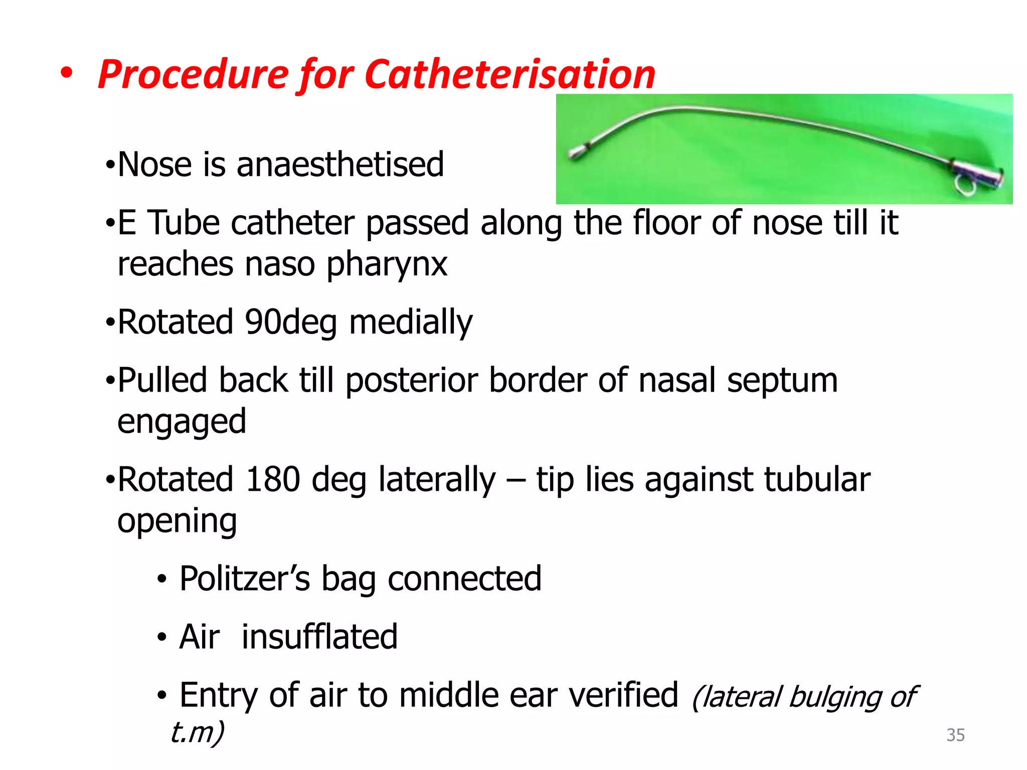 Eustachian tube, anatomy, test and disorders, dr.vijaya sundarm, 20.03.17