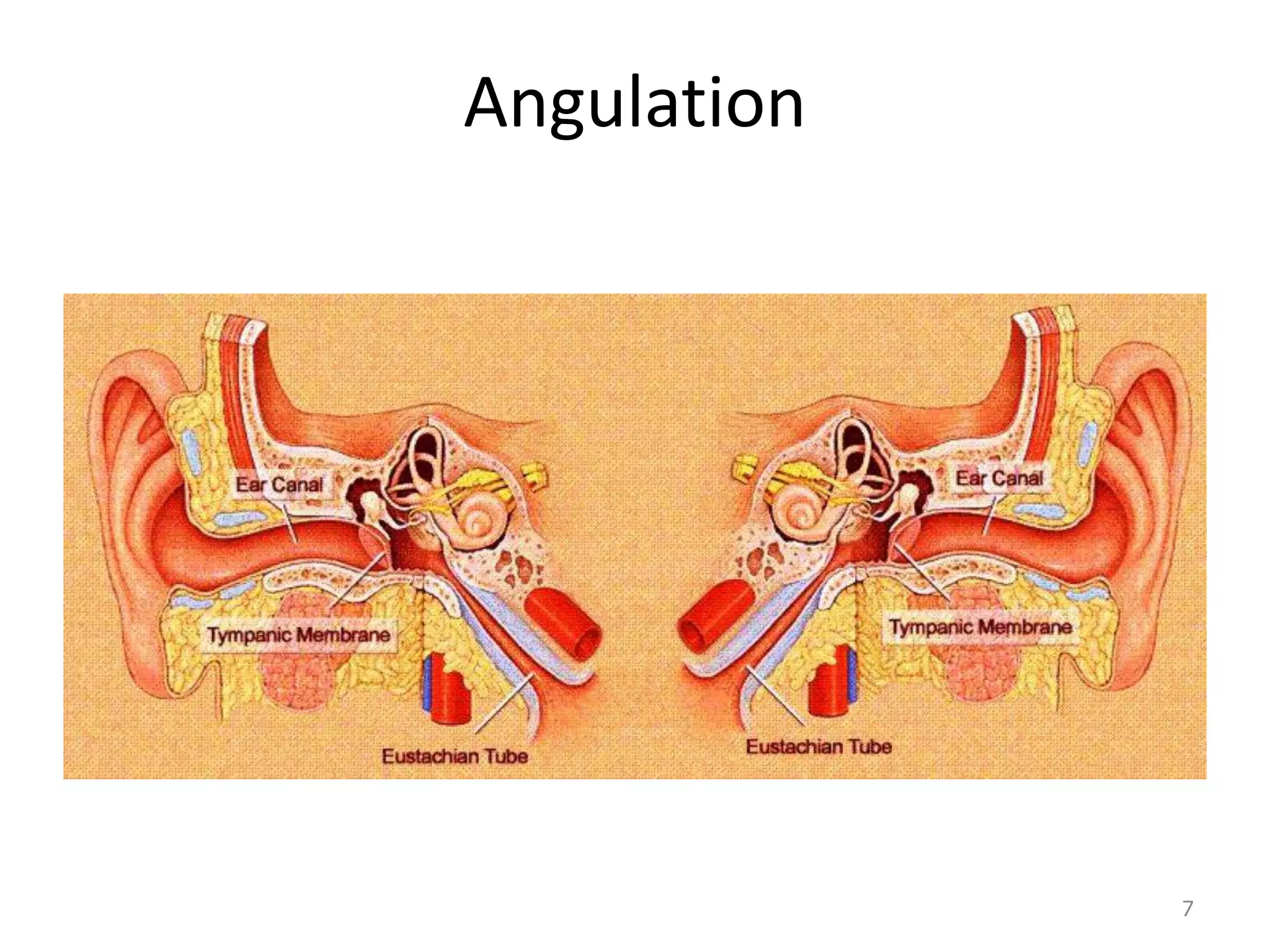 Eustachian tube, anatomy, test and disorders, dr.vijaya sundarm, 20.03.17