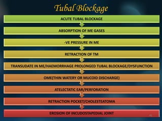 Eustachian tube, anatomy, test and disorders, dr.vijaya sundarm, 20.03.17