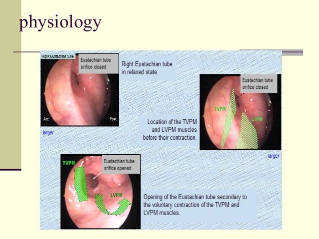 Eustachian tube; anatomy test & disorders 8.2.2016 Dr.Bakshi