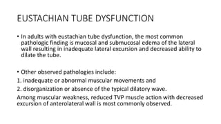 Eustachian tube dysfunction diagnosis and treatment | PPT
