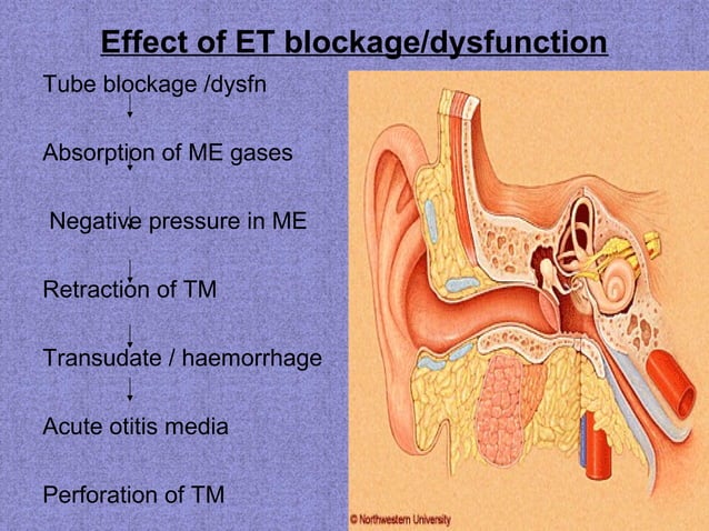 Eustachian tube final PP ANATOMY,EMBRYOLOGY,FUNCTIONS,DYSFUNCTIONS ...