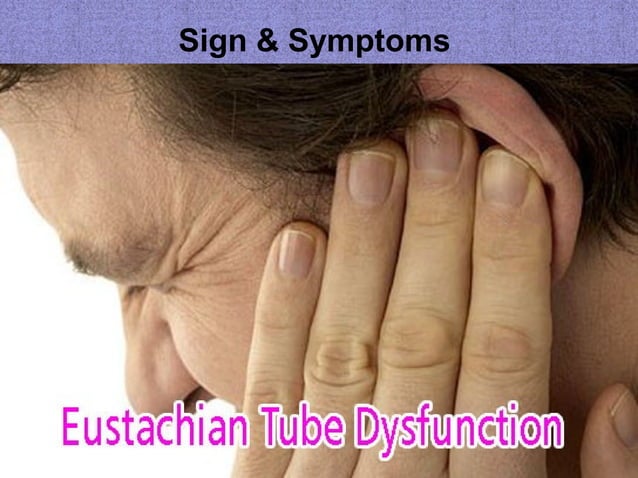 Eustachian Tube Final Pp Anatomyembryologyfunctions