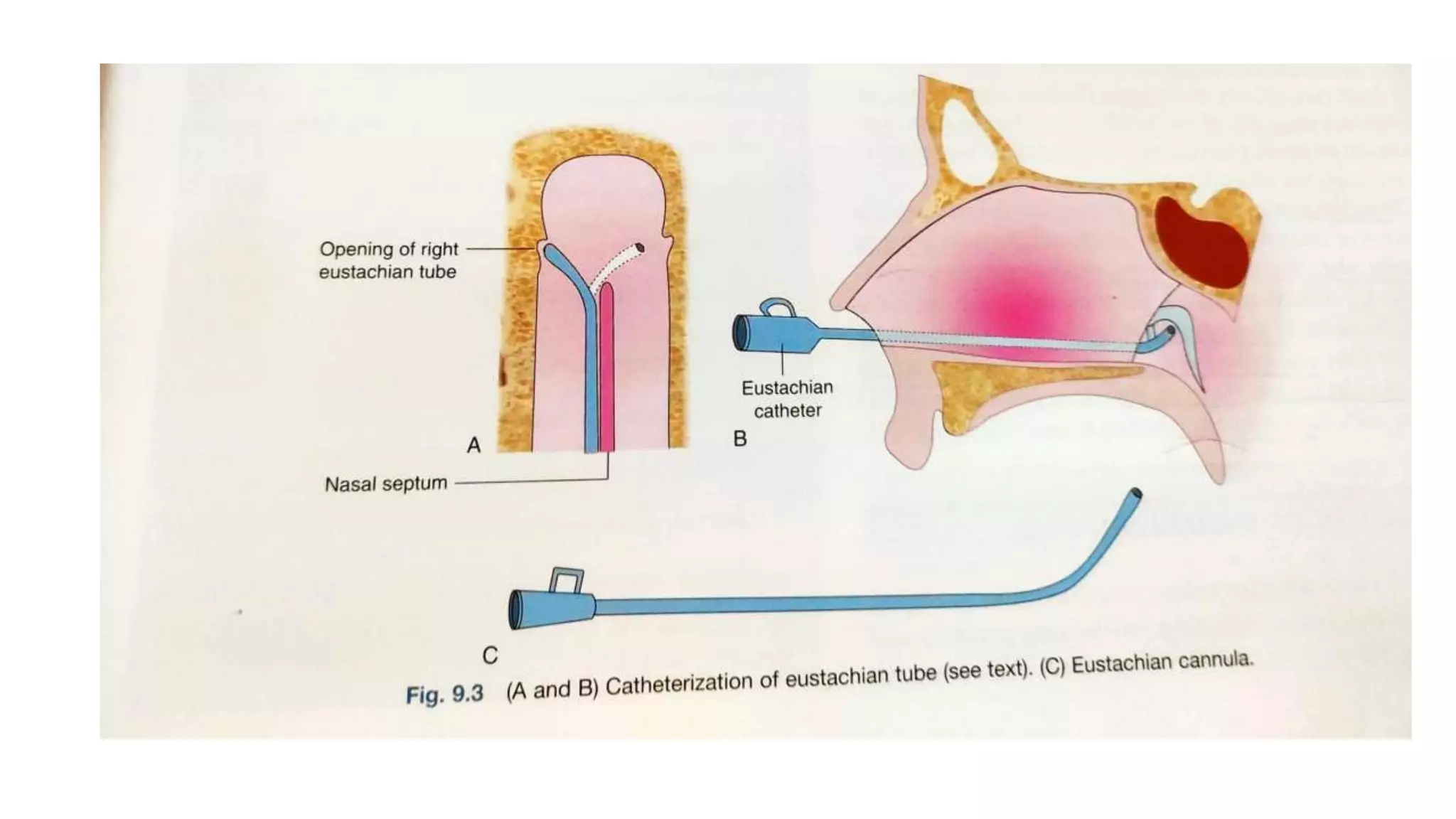 eustachian tube function tests.pptx