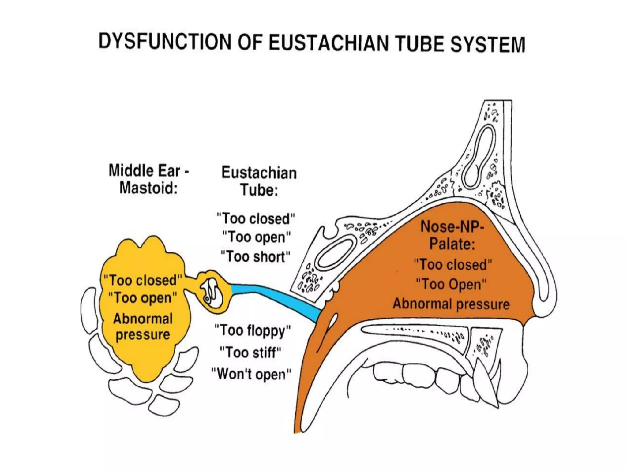 Eustachian Tube | PPTX