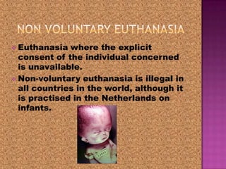 Euthanasia-Right to live or Right to die?? | PPTX