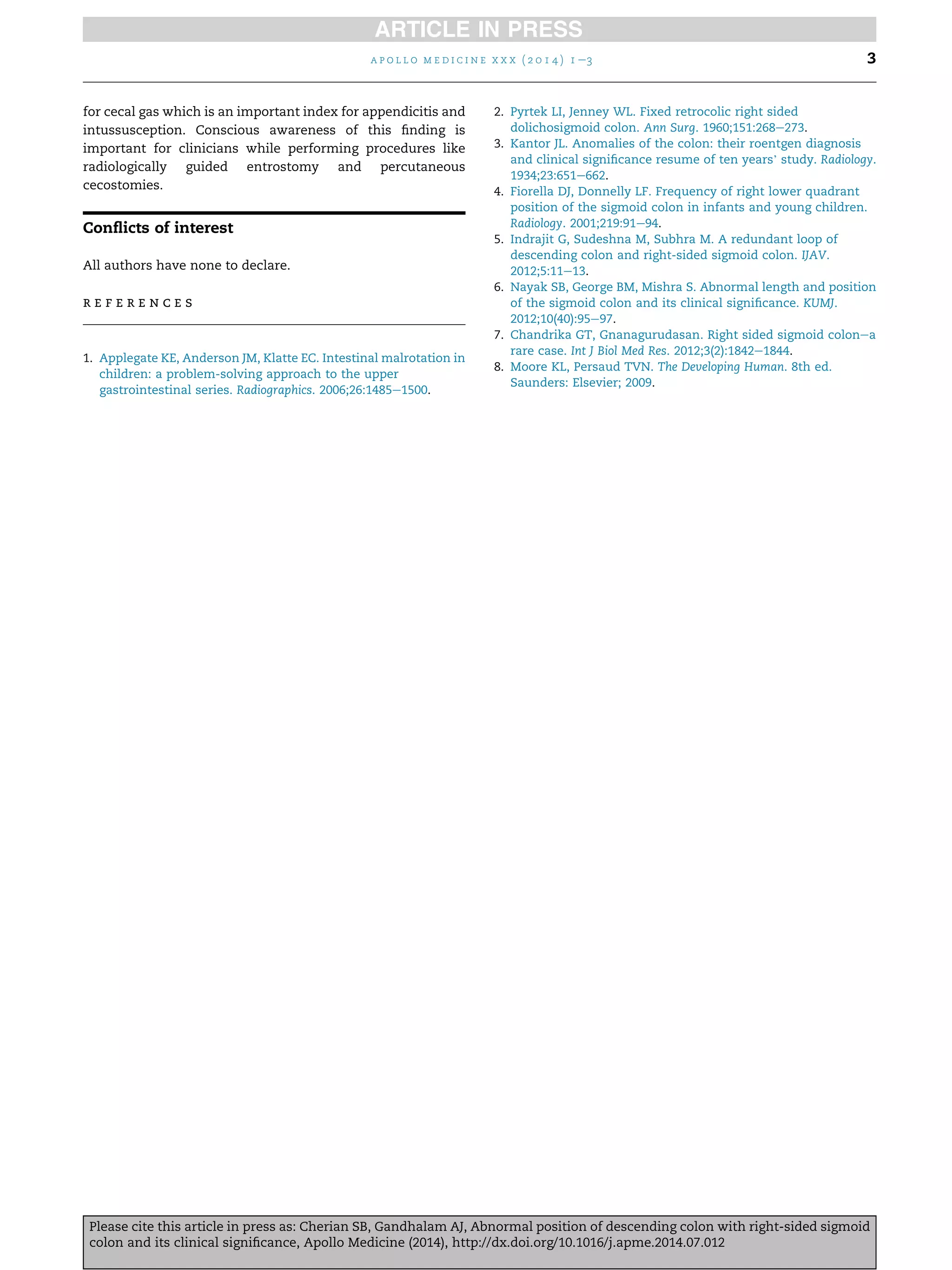 Abnormal position of descending colon with right-sided sigmoid colon ...