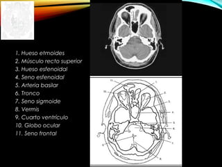 ANATOMÍA DEL CRÁNEO | PPT