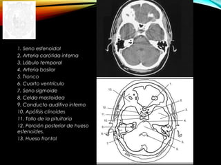ANATOMÍA DEL CRÁNEO | PPT