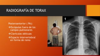 Evaluación cardiaca por radiografía | PPTX