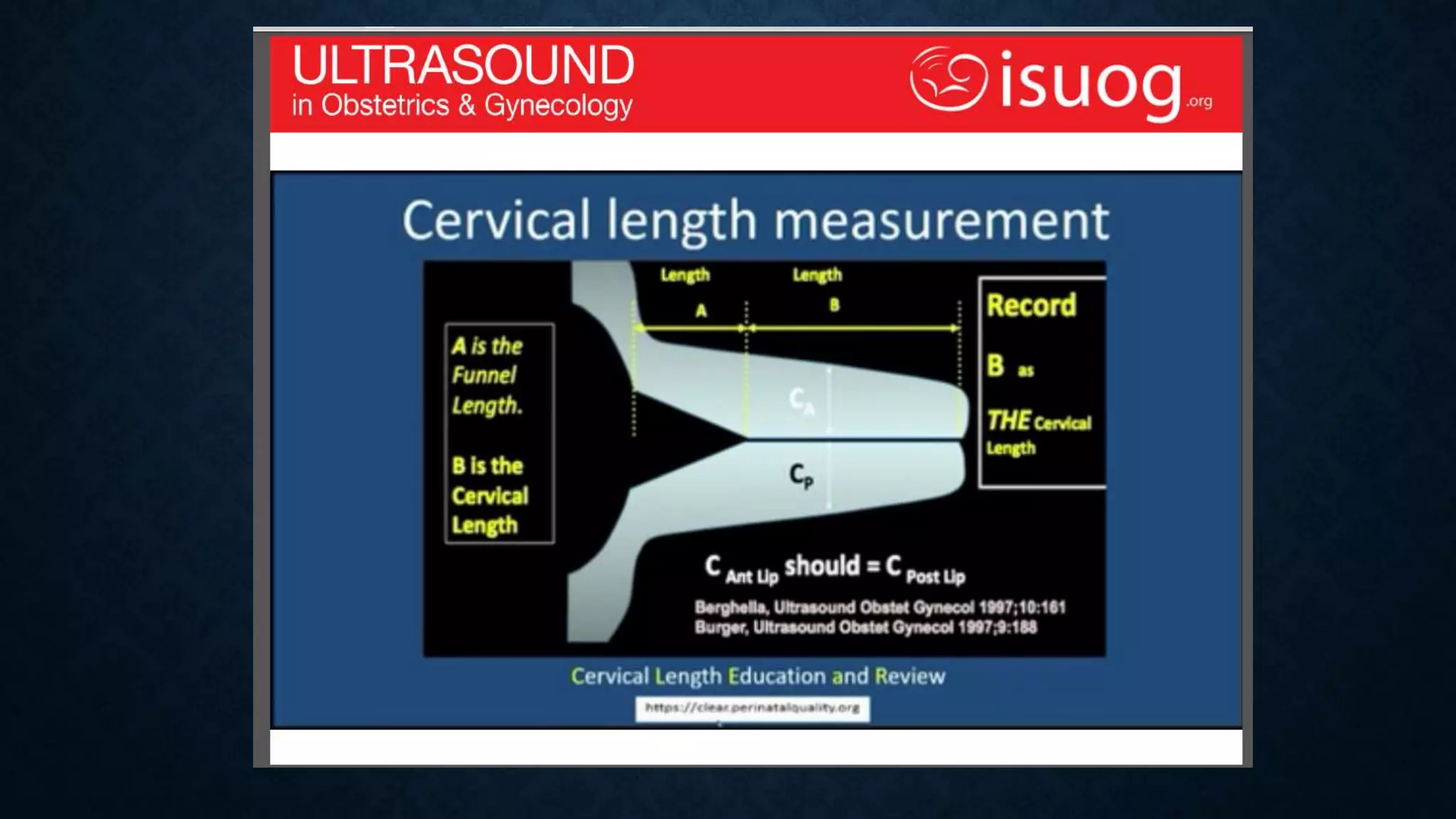 Evaluación de la longitud cervical | PPTX