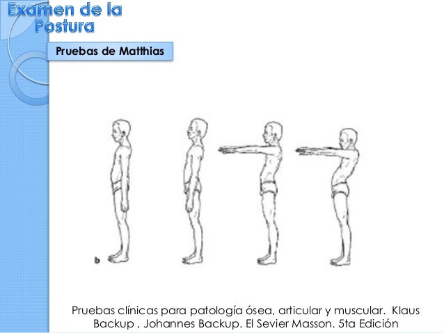 Evaluación de la Postura